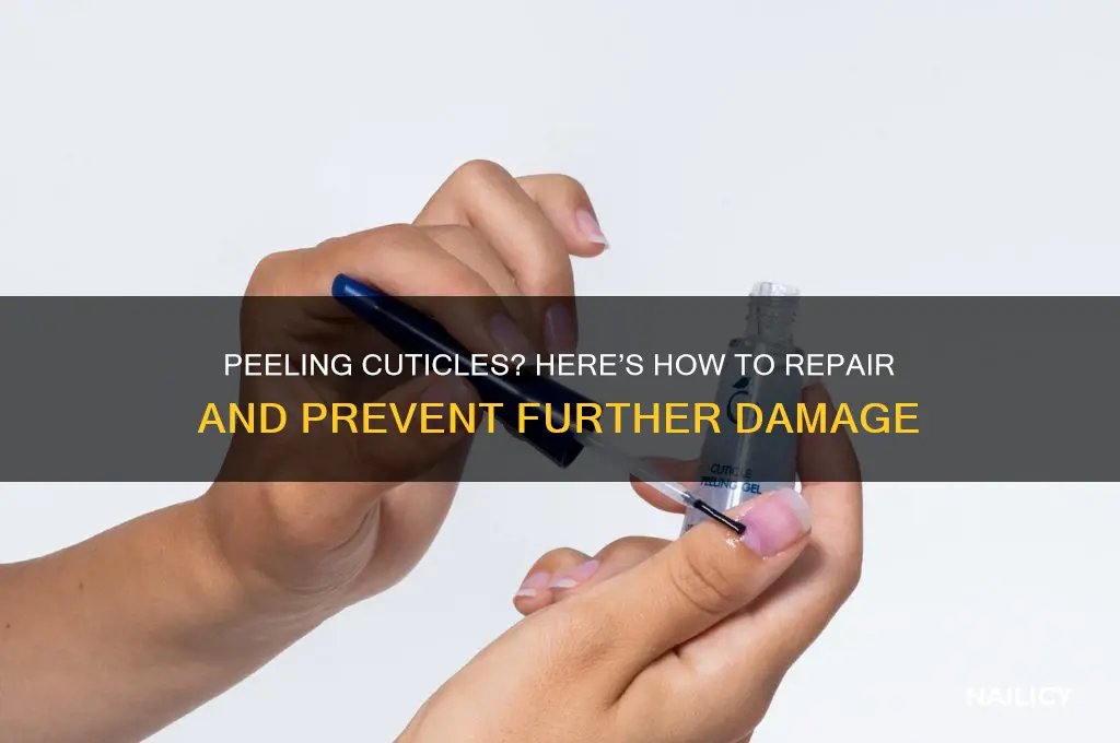 Peeling Cuticles? Here’S How To Repair And Prevent Further Damage | Nailicy