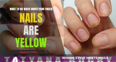 How To Treat A Ripped Fingernail At Home | Nailicy