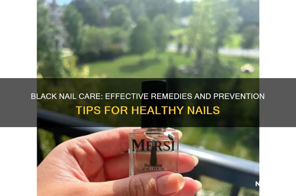 Black Nail Care: Effective Remedies And Prevention Tips For Healthy ...