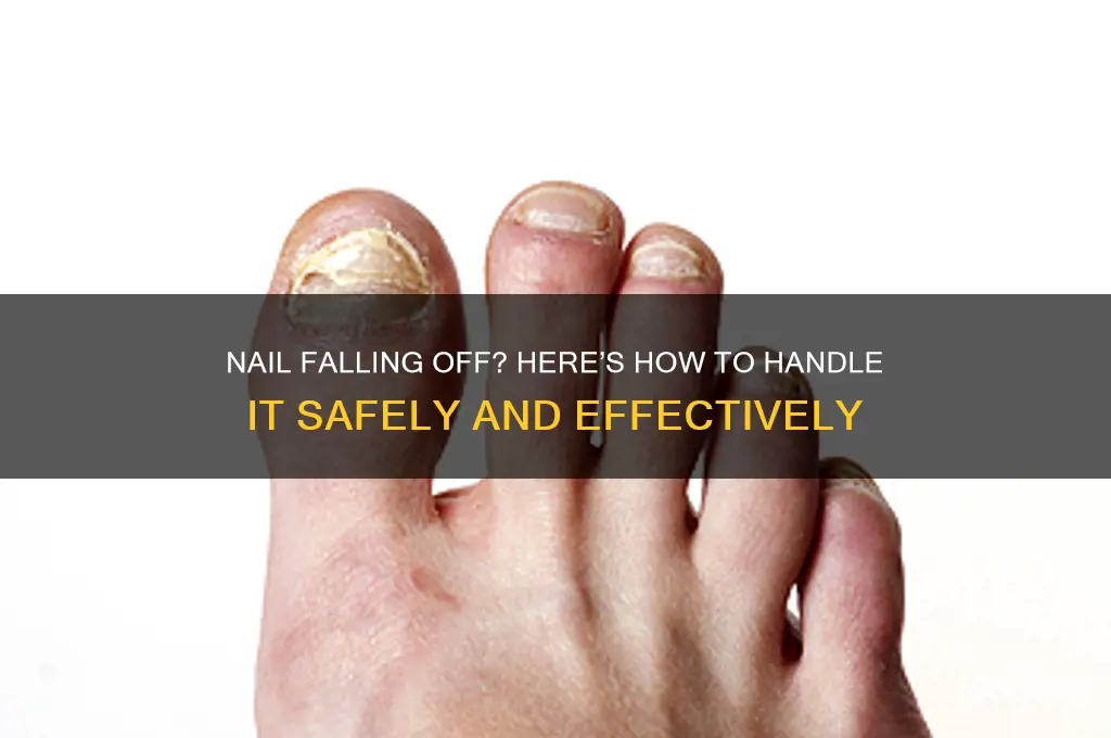 Nail Falling Off? Here’S How To Handle It Safely And Effectively | Nailicy
