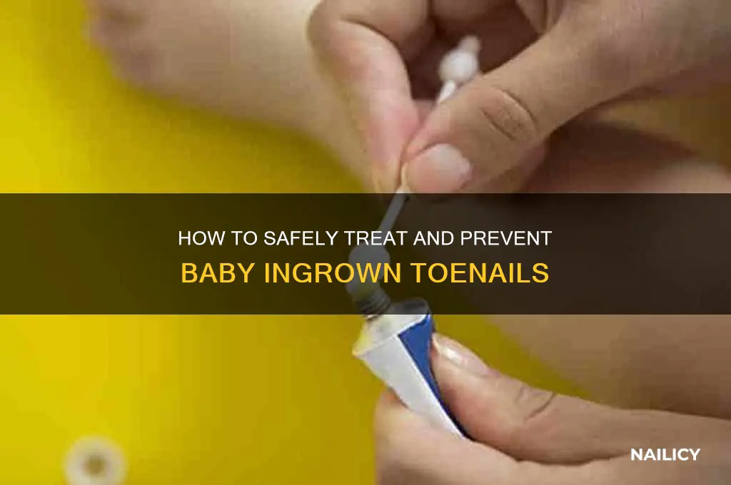 How To Safely Treat And Prevent Baby Ingrown Toenails | Nailicy