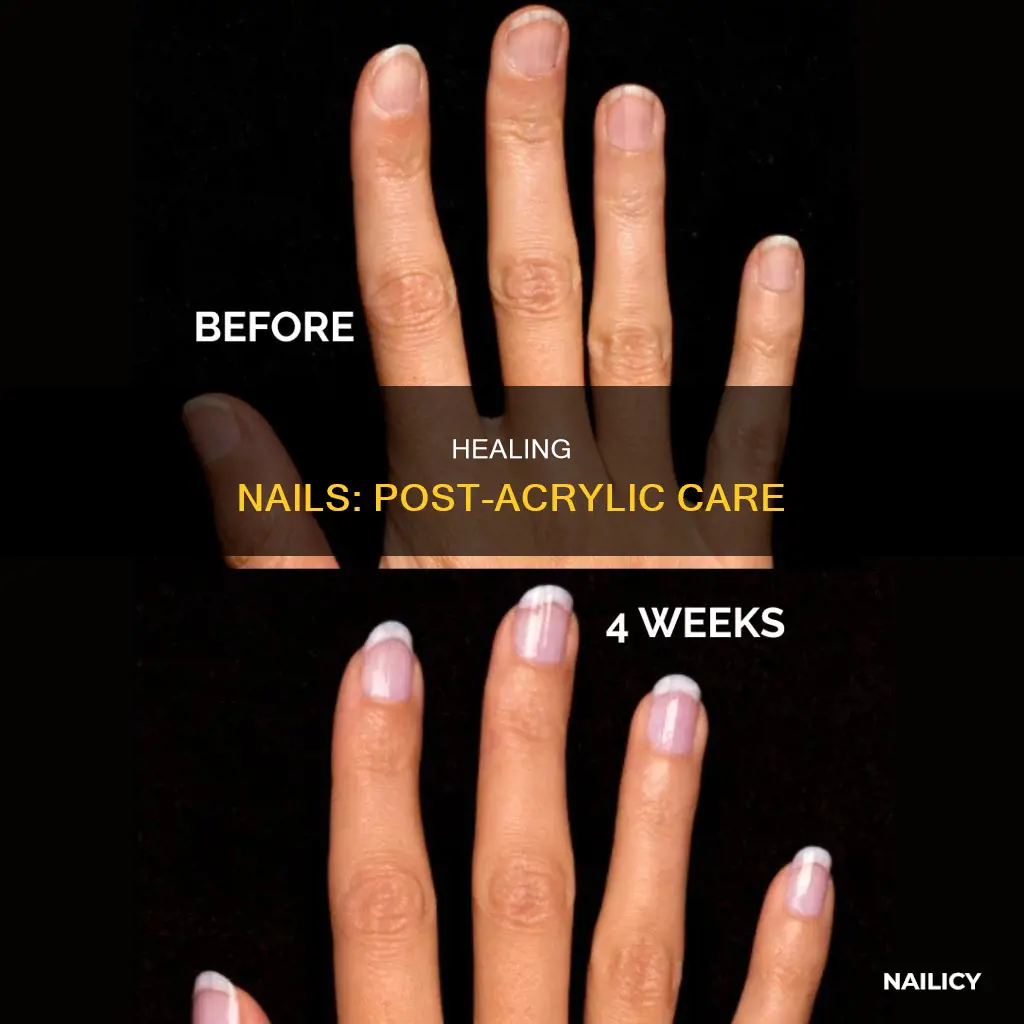 Healing Nails: Post-Acrylic Care | Nailicy