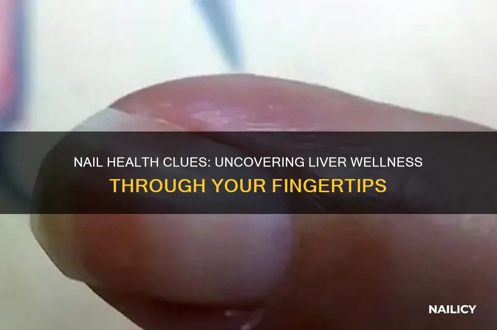 Nail Health Clues: Uncovering Liver Wellness Through Your Fingertips ...