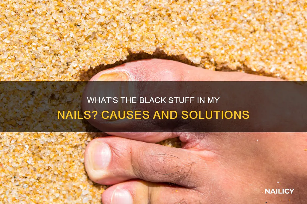 What's The Black Stuff In My Nails? Causes And Solutions | Nailicy