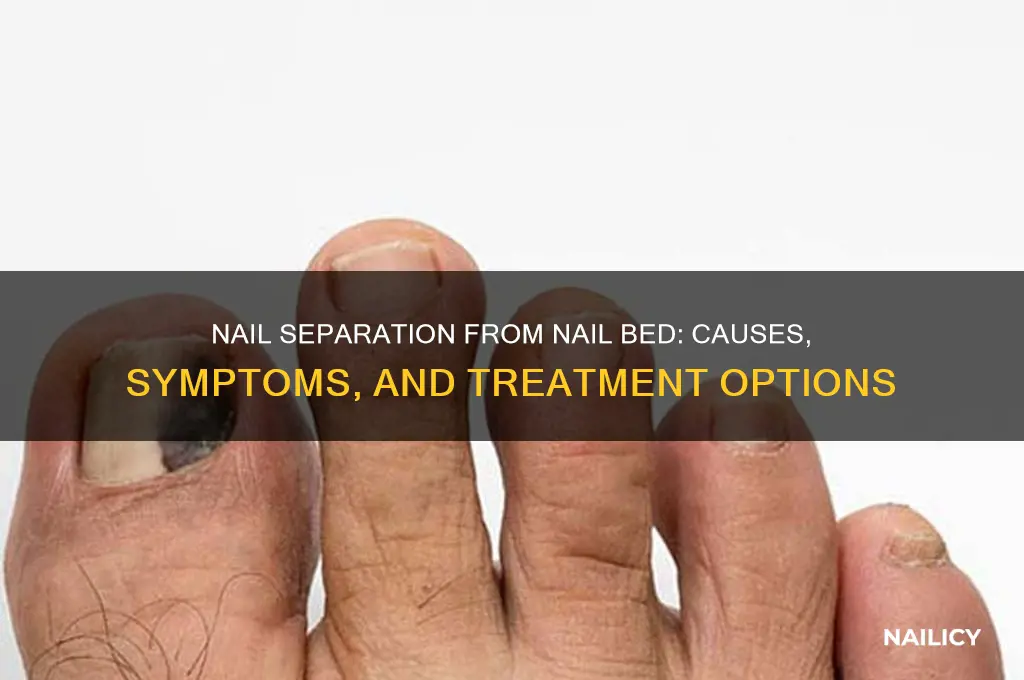 Nail Separation From Nail Bed: Causes, Symptoms, And Treatment Options ...