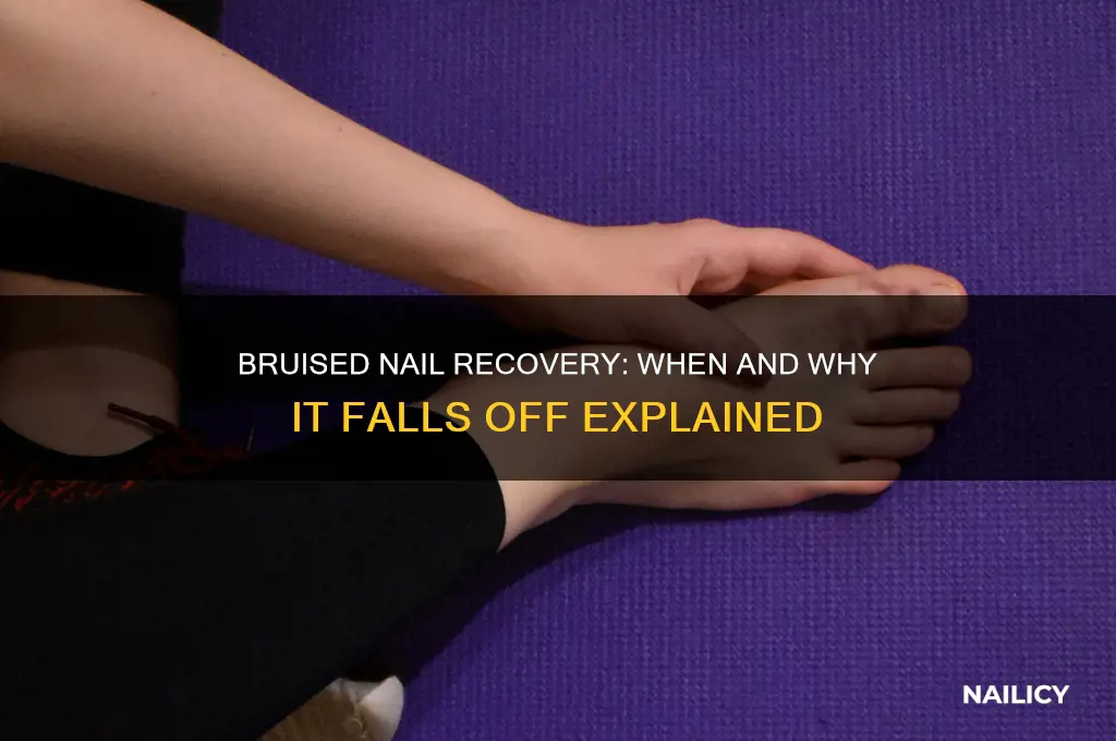 Bruised Nail Recovery: When And Why It Falls Off Explained | Nailicy