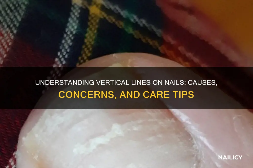 Understanding Vertical Lines On Nails: Causes, Concerns, And Care Tips ...