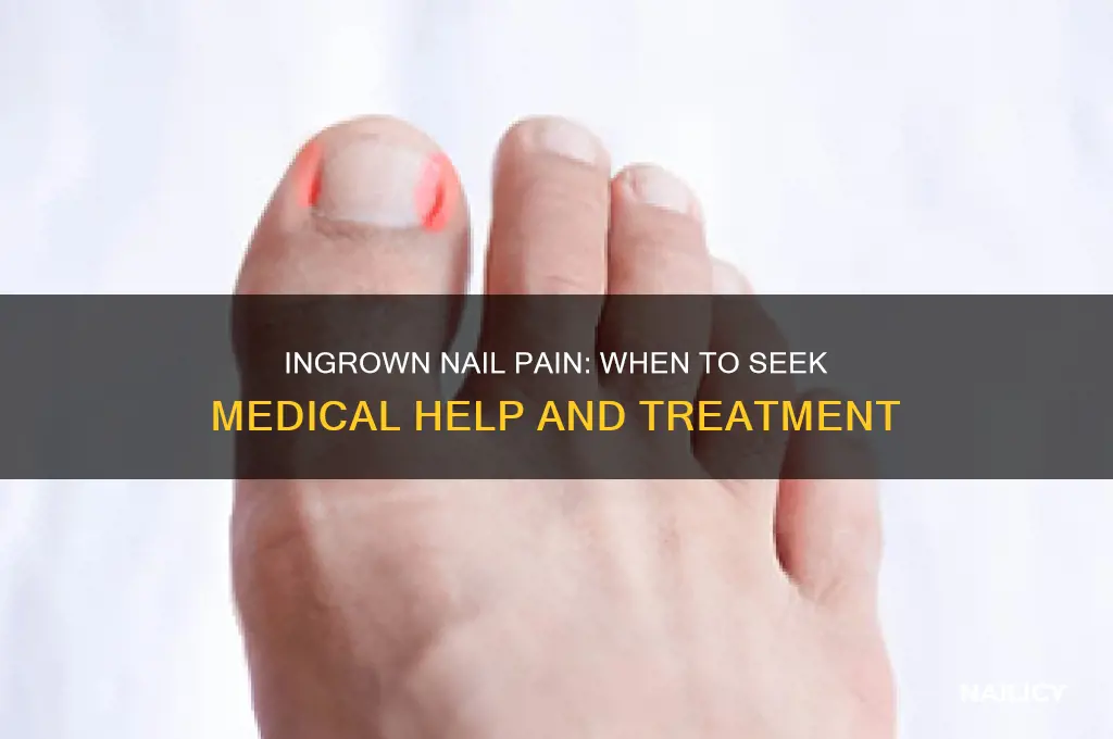 Ingrown Nail Pain: When To Seek Medical Help And Treatment | Nailicy