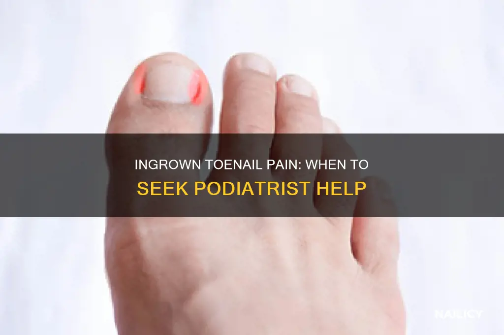 Ingrown Toenail Pain: When To Seek Podiatrist Help | Nailicy