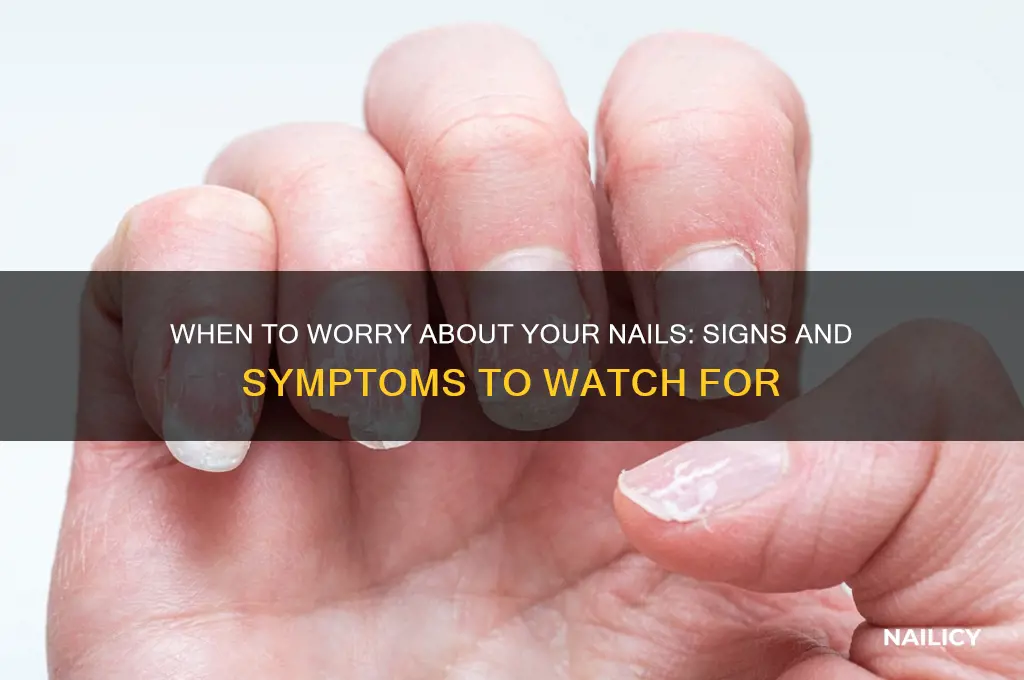When To Worry About Your Nails: Signs And Symptoms To Watch For | Nailicy