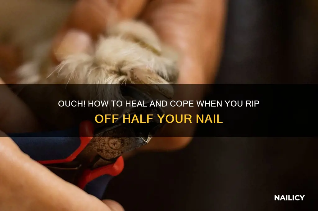 Ouch! How To Heal And Cope When You Rip Off Half Your Nail | Nailicy