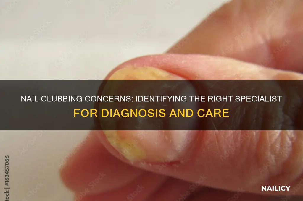 Nail Clubbing Concerns: Identifying The Right Specialist For Diagnosis ...