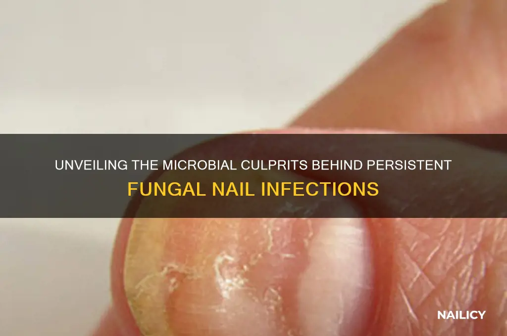 Unveiling The Microbial Culprits Behind Persistent Fungal Nail ...