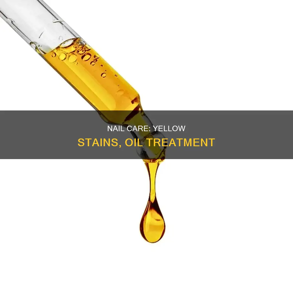 Nail Care: Yellow Stains, Oil Treatment | Nailicy