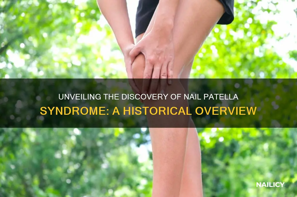 Unveiling The Discovery Of Nail Patella Syndrome: A Historical Overview ...