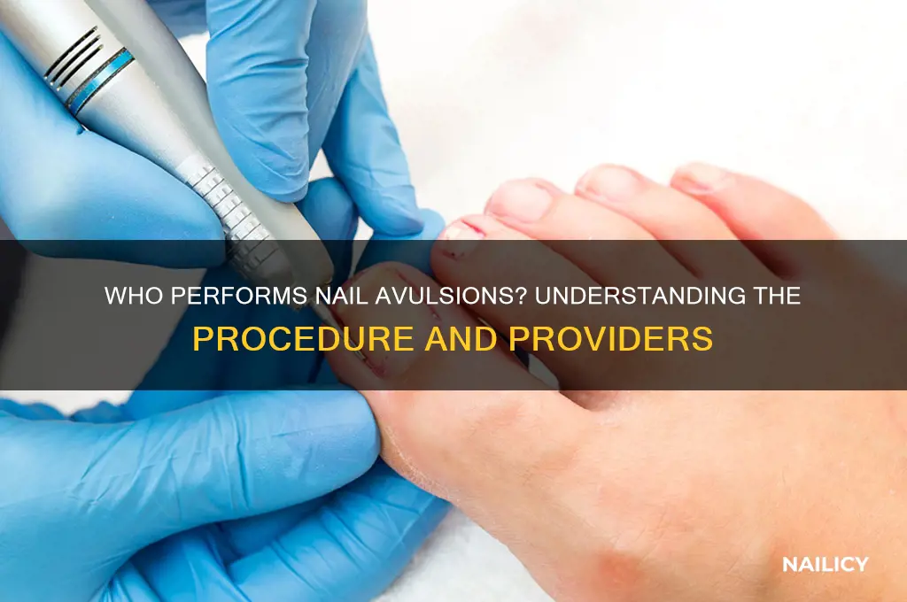 Who Performs Nail Avulsions? Understanding The Procedure And Providers ...