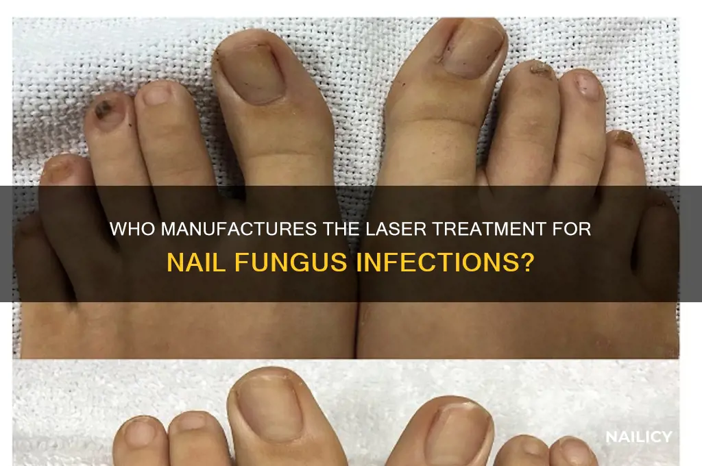 Who Manufactures The Laser Treatment For Nail Fungus Infections? | Nailicy