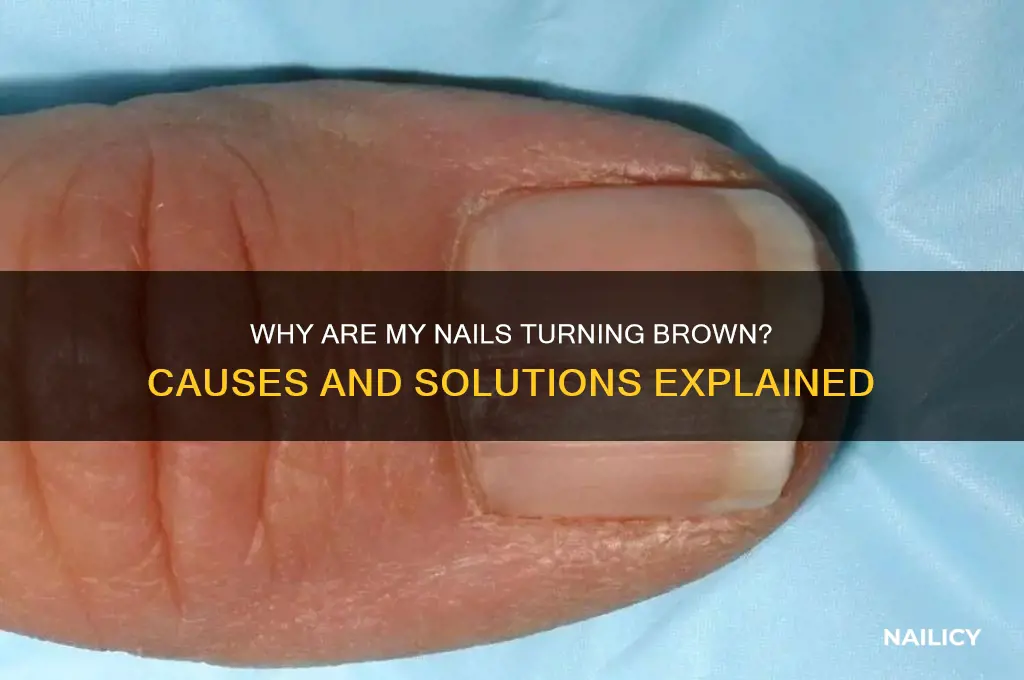 Why Are My Nails Turning Brown? Causes And Solutions Explained | Nailicy