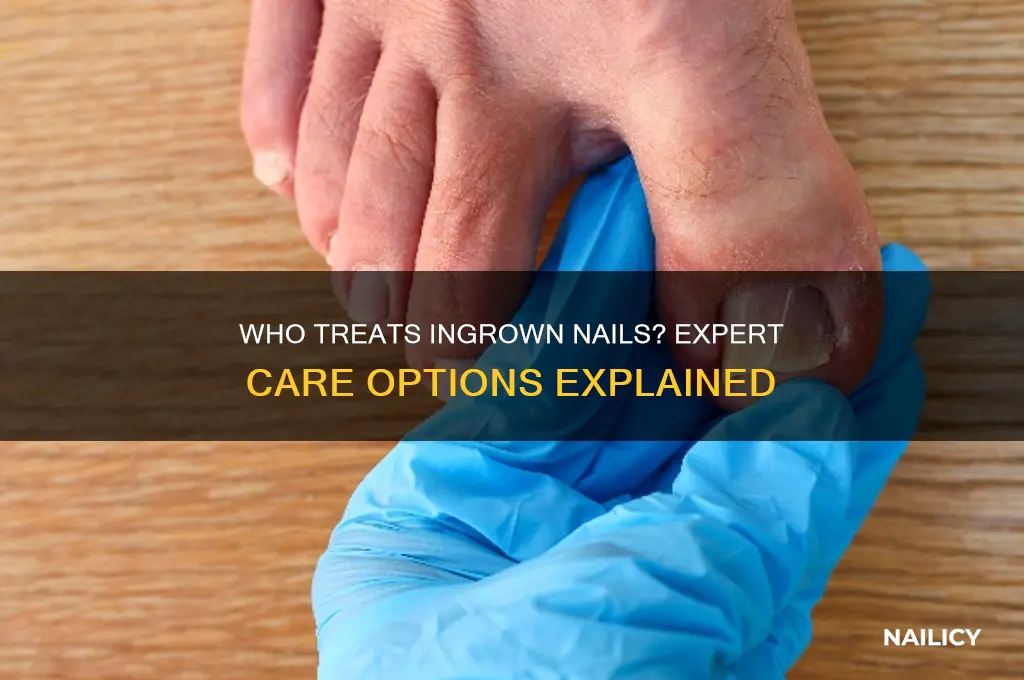 Who Treats Ingrown Nails? Expert Care Options Explained | Nailicy