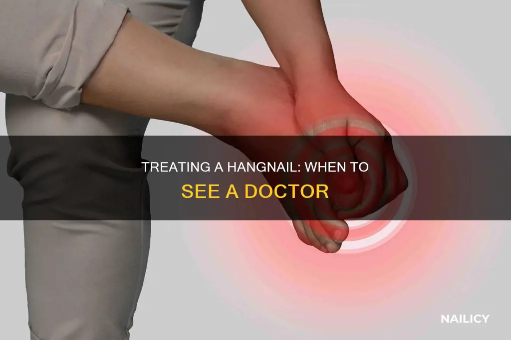 Treating A Hangnail: When To See A Doctor | Nailicy