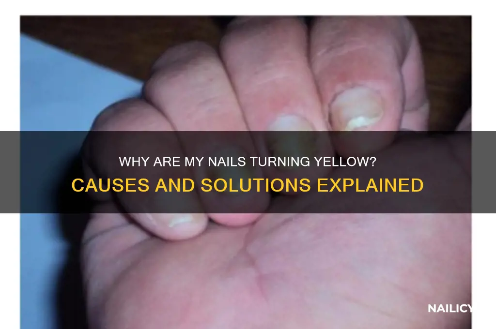 Why Are My Nails Turning Yellow? Causes And Solutions Explained | Nailicy