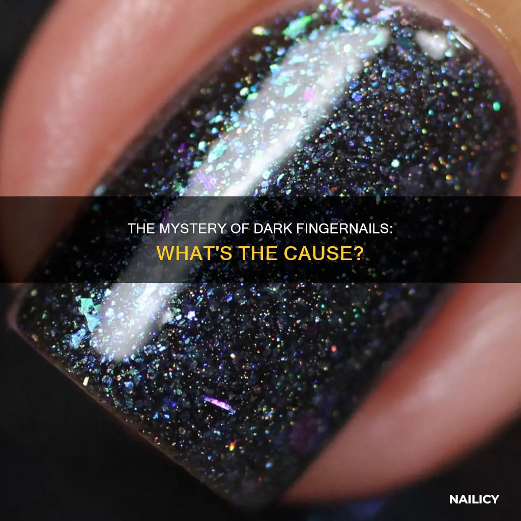 The Mystery Of Dark Fingernails: What's The Cause? | Nailicy