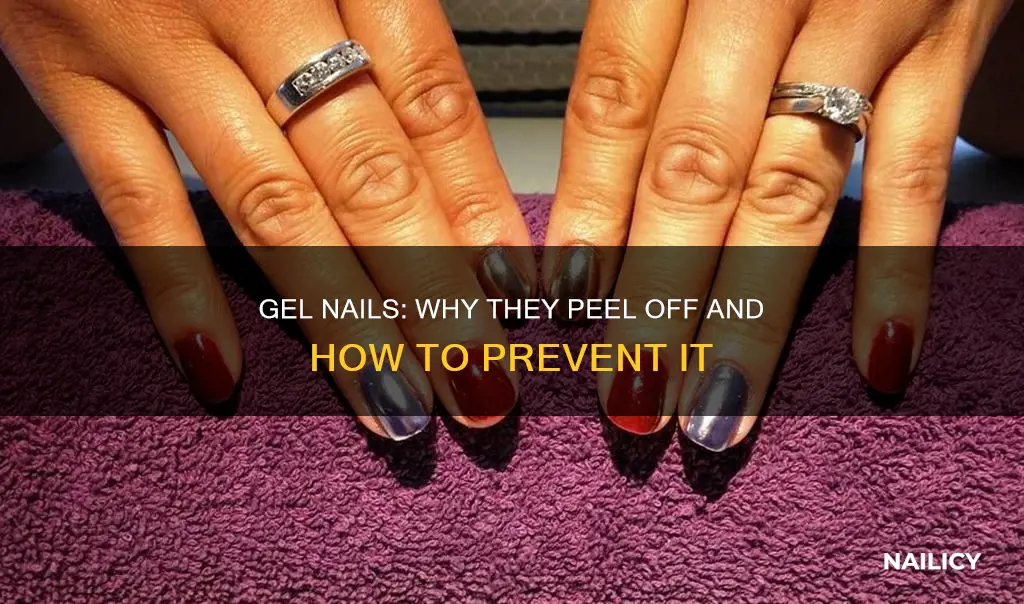 Gel Nails: Why They Peel Off And How To Prevent It | Nailicy
