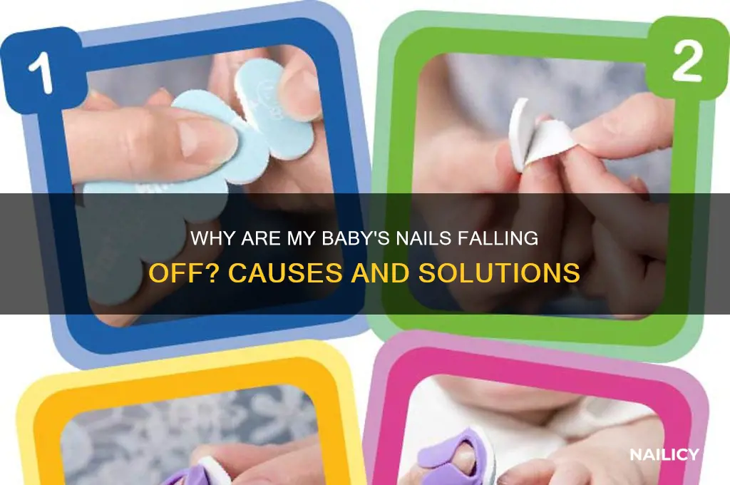 Why Are My Baby's Nails Falling Off? Causes And Solutions | Nailicy
