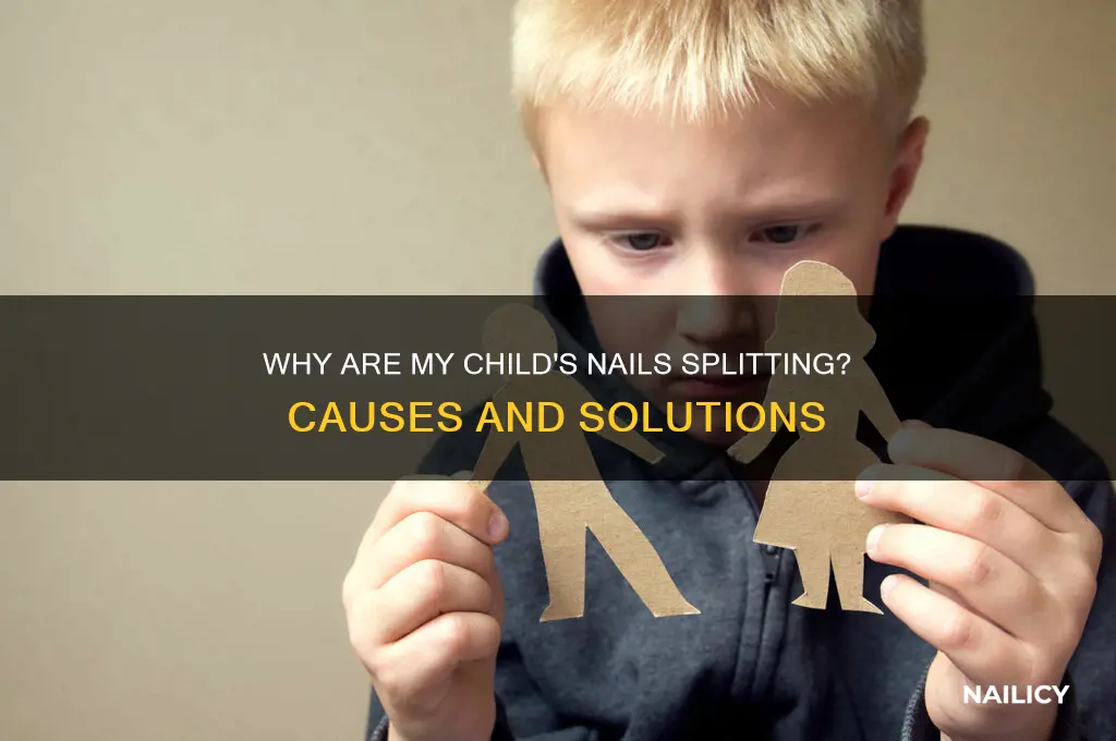 Why Are My Child's Nails Splitting? Causes And Solutions | Nailicy