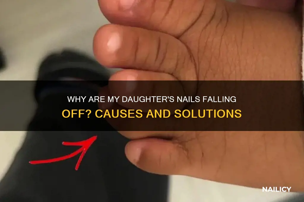 Why Are My Daughter's Nails Falling Off? Causes And Solutions | Nailicy