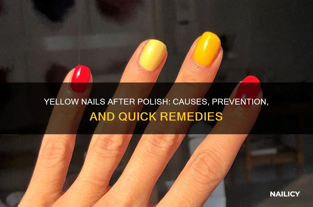 Yellow Nails After Polish: Causes, Prevention, And Quick Remedies | Nailicy