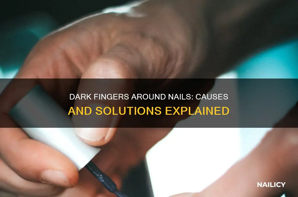 Dark Fingers Around Nails: Causes And Solutions Explained | Nailicy