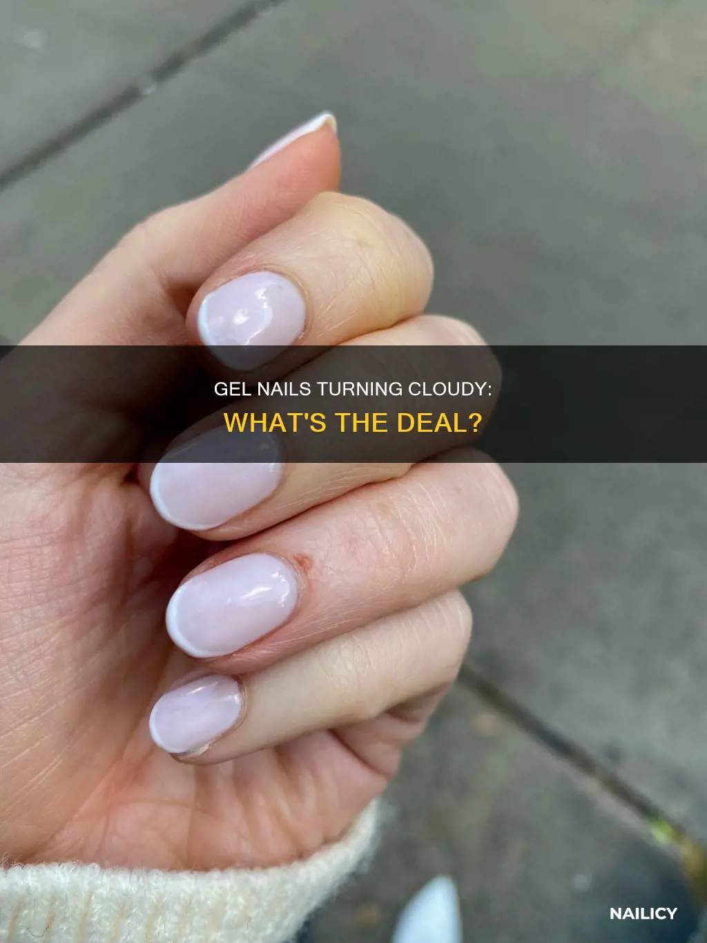 Gel Nails Turning Cloudy: What's The Deal? | Nailicy
