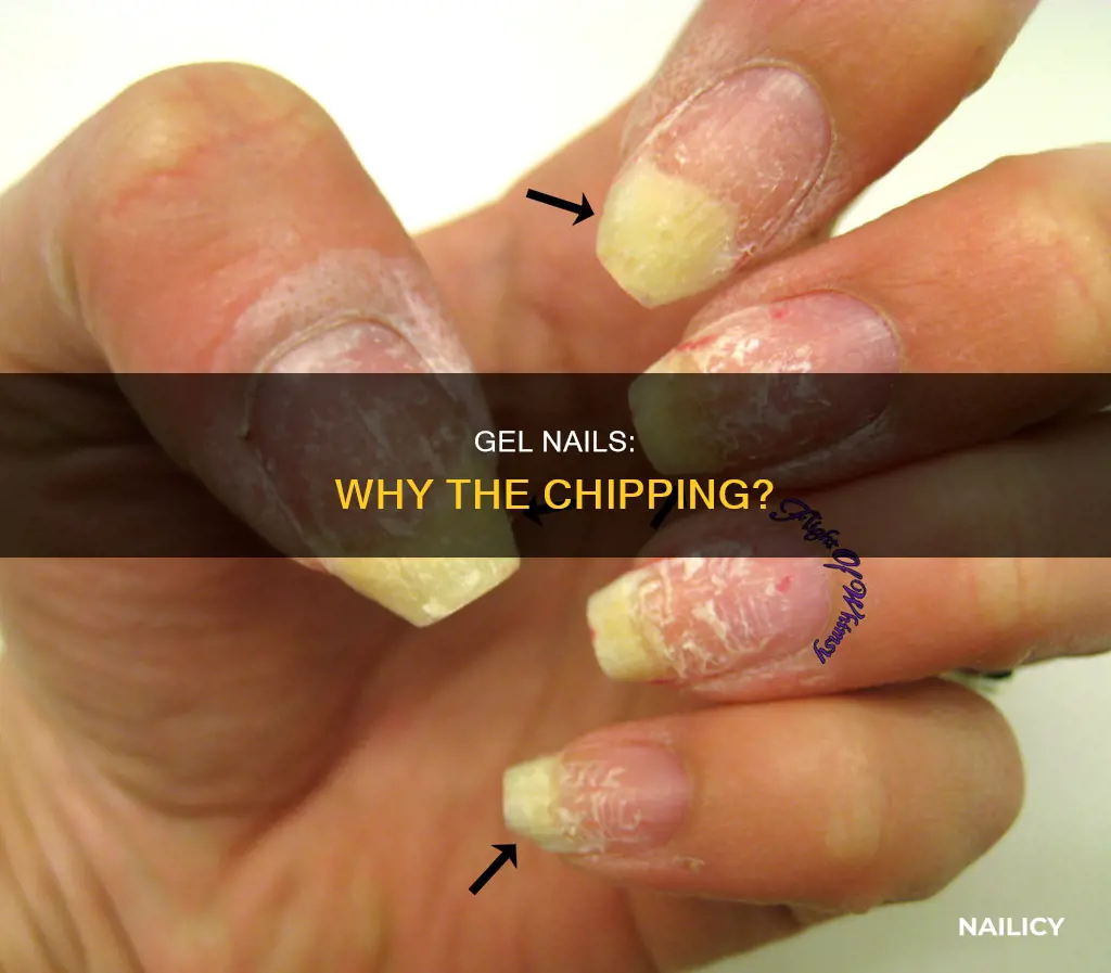 Gel Nails: Why The Chipping? | Nailicy
