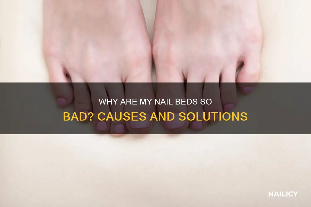 Why Are My Nail Beds So Bad? Causes And Solutions | Nailicy