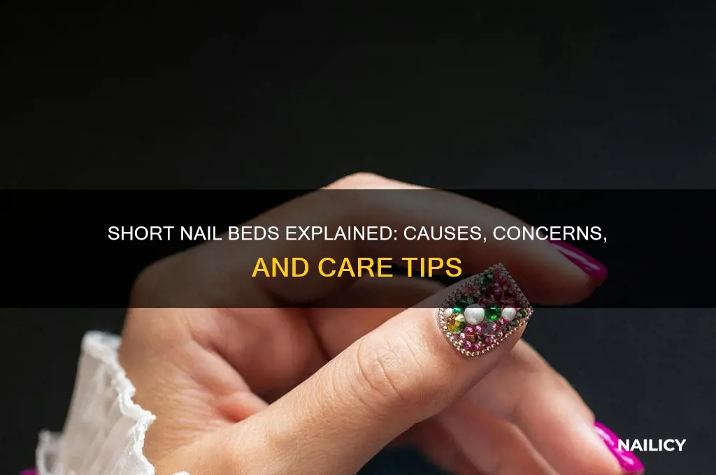 Short Nail Beds Explained: Causes, Concerns, And Care Tips | Nailicy