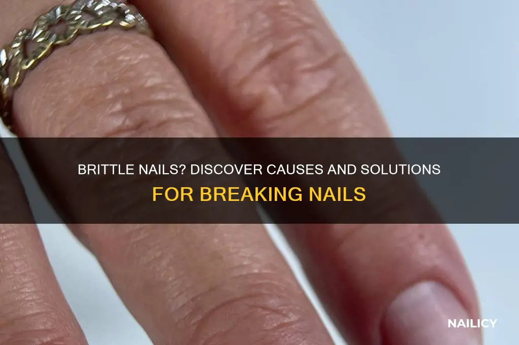 Brittle Nails? Discover Causes And Solutions For Breaking Nails | Nailicy