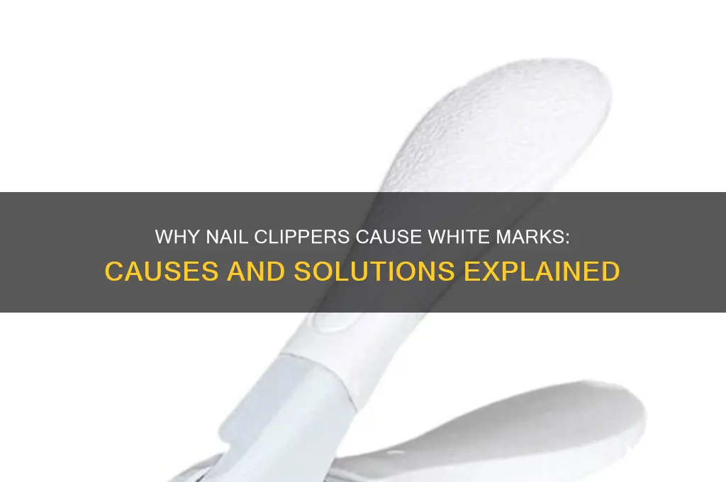 Why Nail Clippers Cause White Marks: Causes And Solutions Explained ...