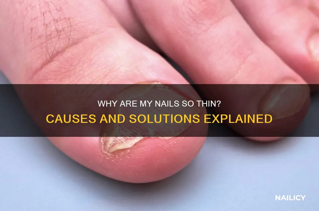 Why Are My Nails So Thin? Causes And Solutions Explained | Nailicy