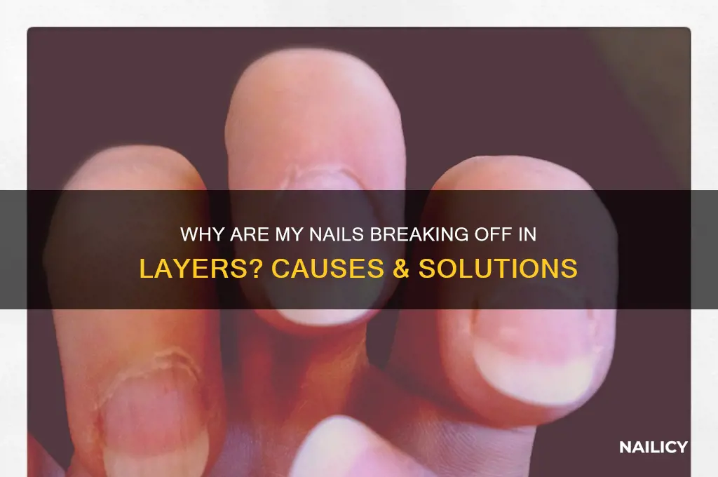 Why Are My Nails Breaking Off In Layers? Causes & Solutions | Nailicy