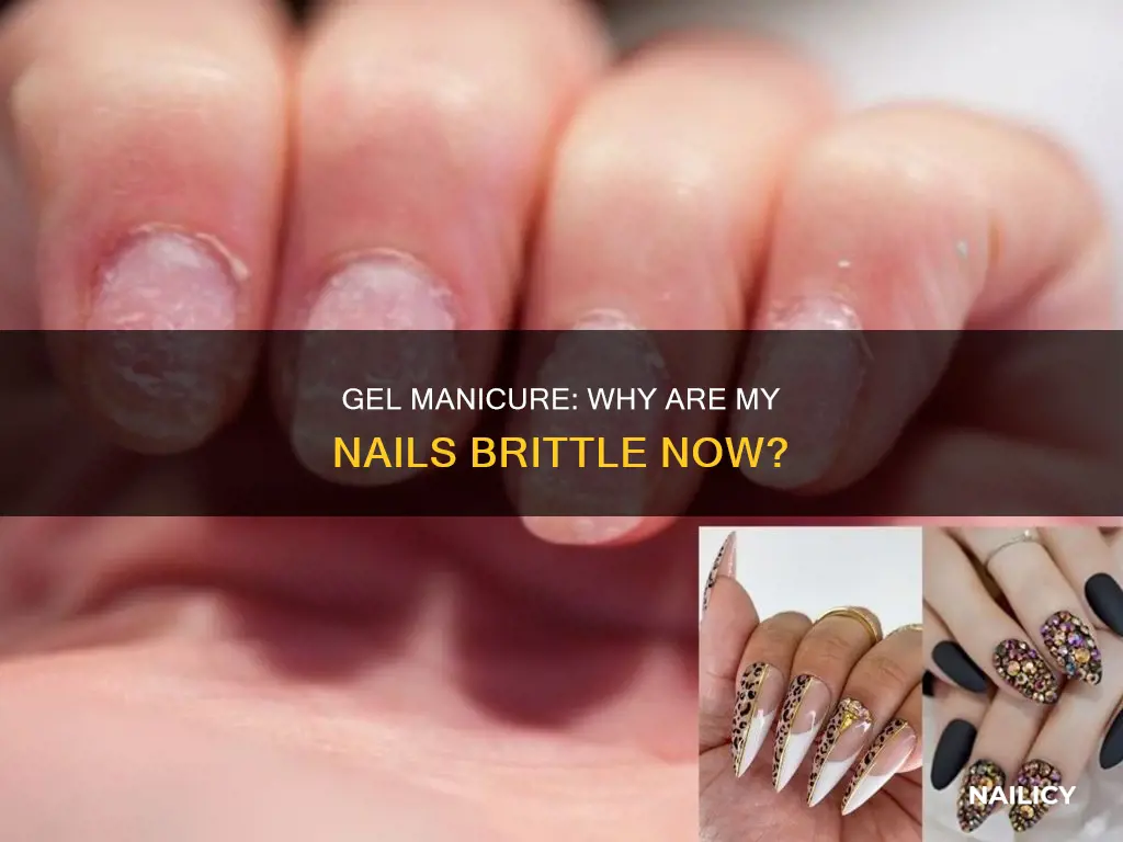 Gel Manicure: Why Are My Nails Brittle Now? | Nailicy