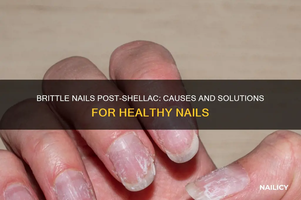 Brittle Nails Post-Shellac: Causes And Solutions For Healthy Nails ...