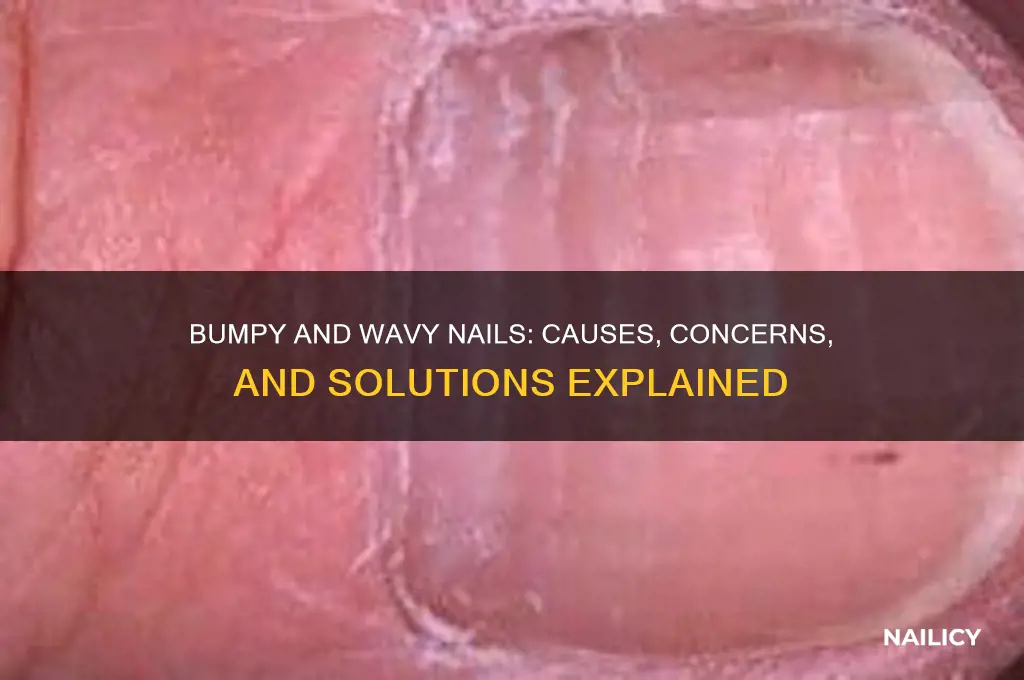 Bumpy And Wavy Nails: Causes, Concerns, And Solutions Explained | Nailicy