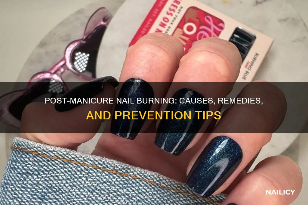 Post-Manicure Nail Burning: Causes, Remedies, And Prevention Tips | Nailicy