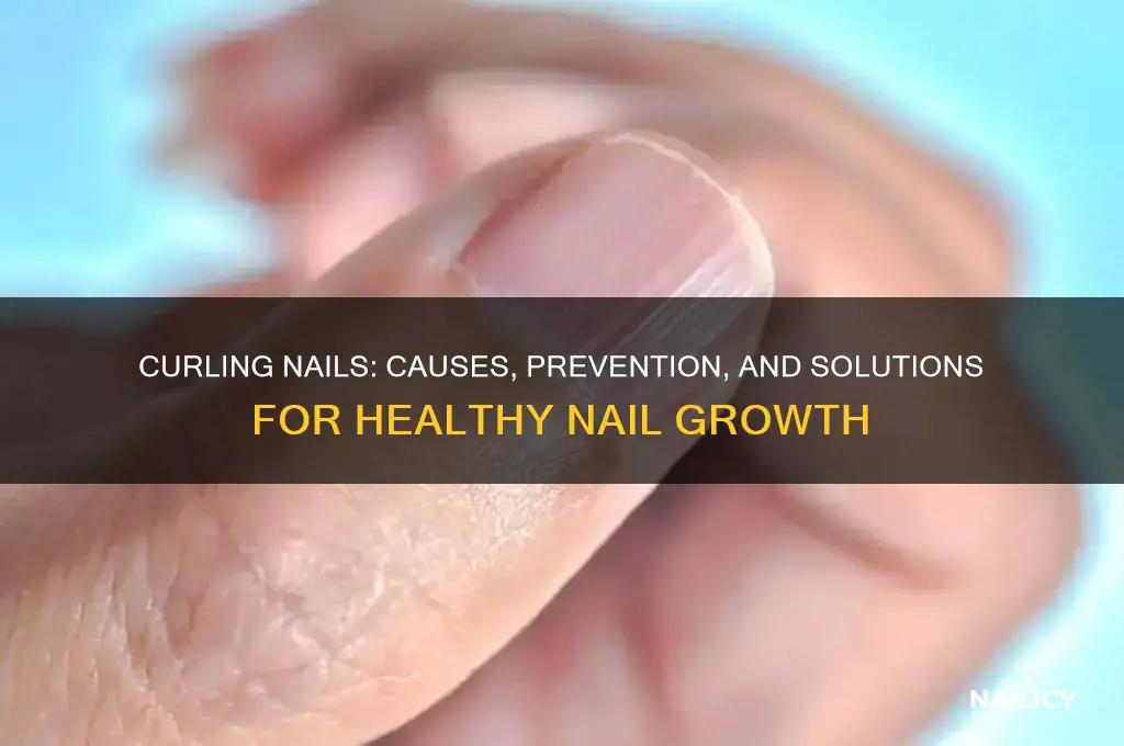 Curling Nails: Causes, Prevention, And Solutions For Healthy Nail ...