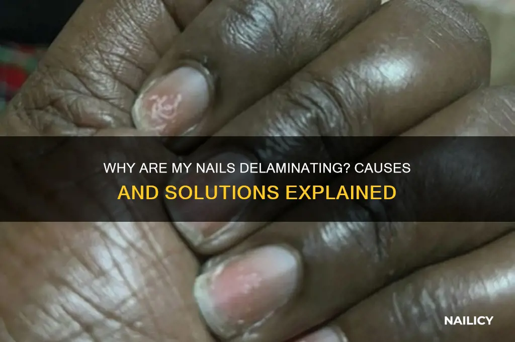 Why Are My Nails Delaminating? Causes And Solutions Explained | Nailicy