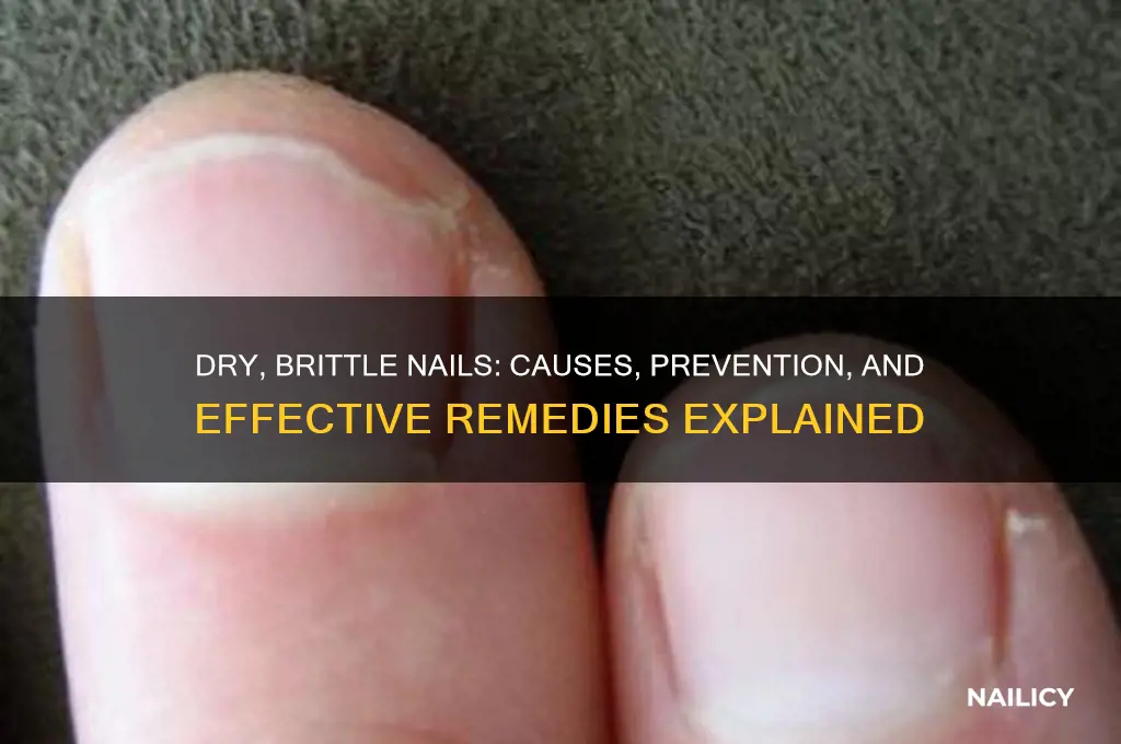 Dry, Brittle Nails: Causes, Prevention, And Effective Remedies ...
