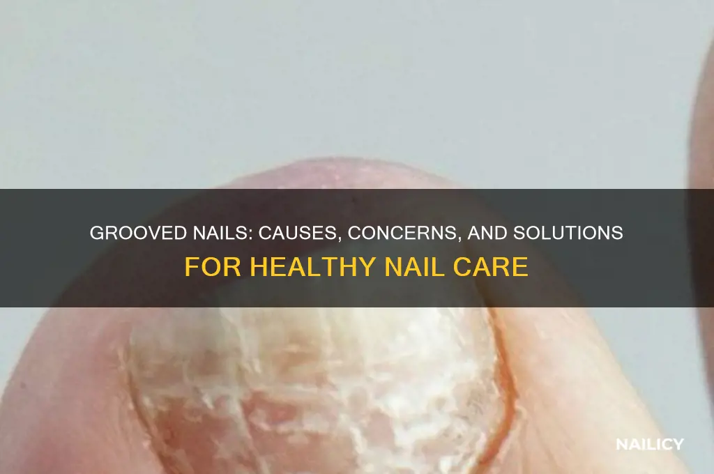 Grooved Nails: Causes, Concerns, And Solutions For Healthy Nail Care ...