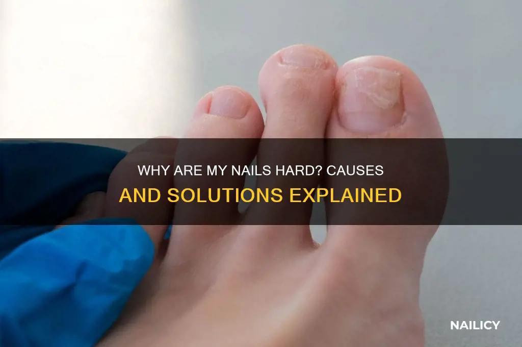 Why Are My Nails Hard? Causes And Solutions Explained | Nailicy
