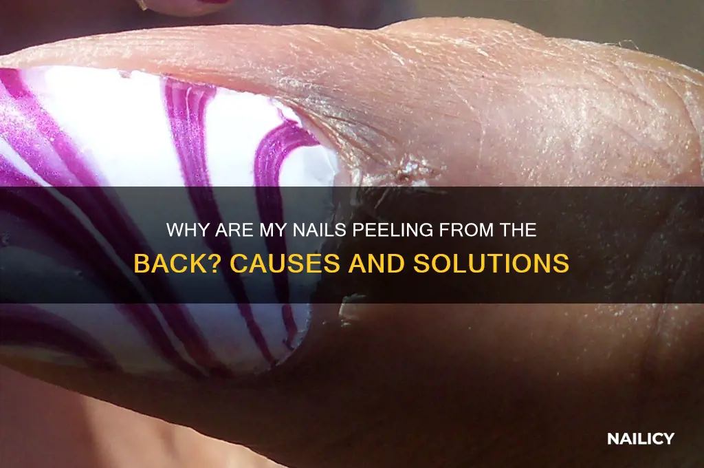Why Are My Nails Peeling From The Back? Causes And Solutions | Nailicy
